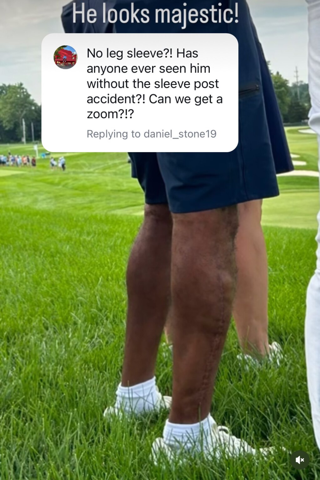 Fans horrified as first photo of Tiger Woods’ leg without sleeve shows ...